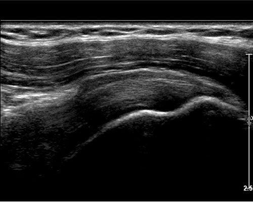 MSK Imaging – Leeds MSK Radiologists