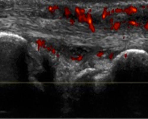 Ultrasound Leeds - Soft Tissue Investigations – Leeds MSK Radiologists