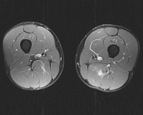 Sports Diagnostic and Therapeutic Radiology Leeds – Leeds MSK Radiologists