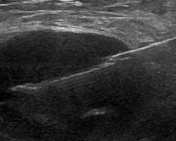 MSK Imaging – Leeds MSK Radiologists