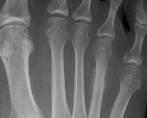 MSK Imaging – Leeds MSK Radiologists